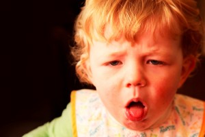 Croup Symptoms, Causes, Risk Factors, Complications, Diagnosis and ...
