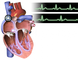 Bradycardia Causes, Symptoms, Diagnosis and Treatment - Natural Health News