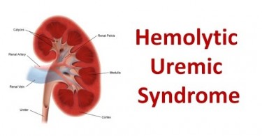 Cellulitis Causes, Symptoms, Diagnosis and Treatment - Natural Health News