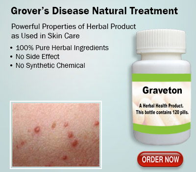 Natural Remedies for Grover’s Disease Causes and Treatment