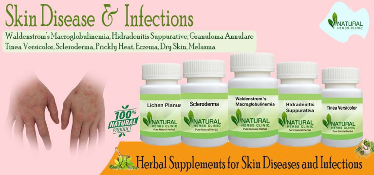 10 Herbal Remedies for Common Skin Problems - Natural Health News