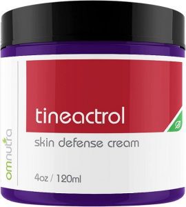 5 Amazing Supplement and Creams for Tinea Versicolor - Natural Health News