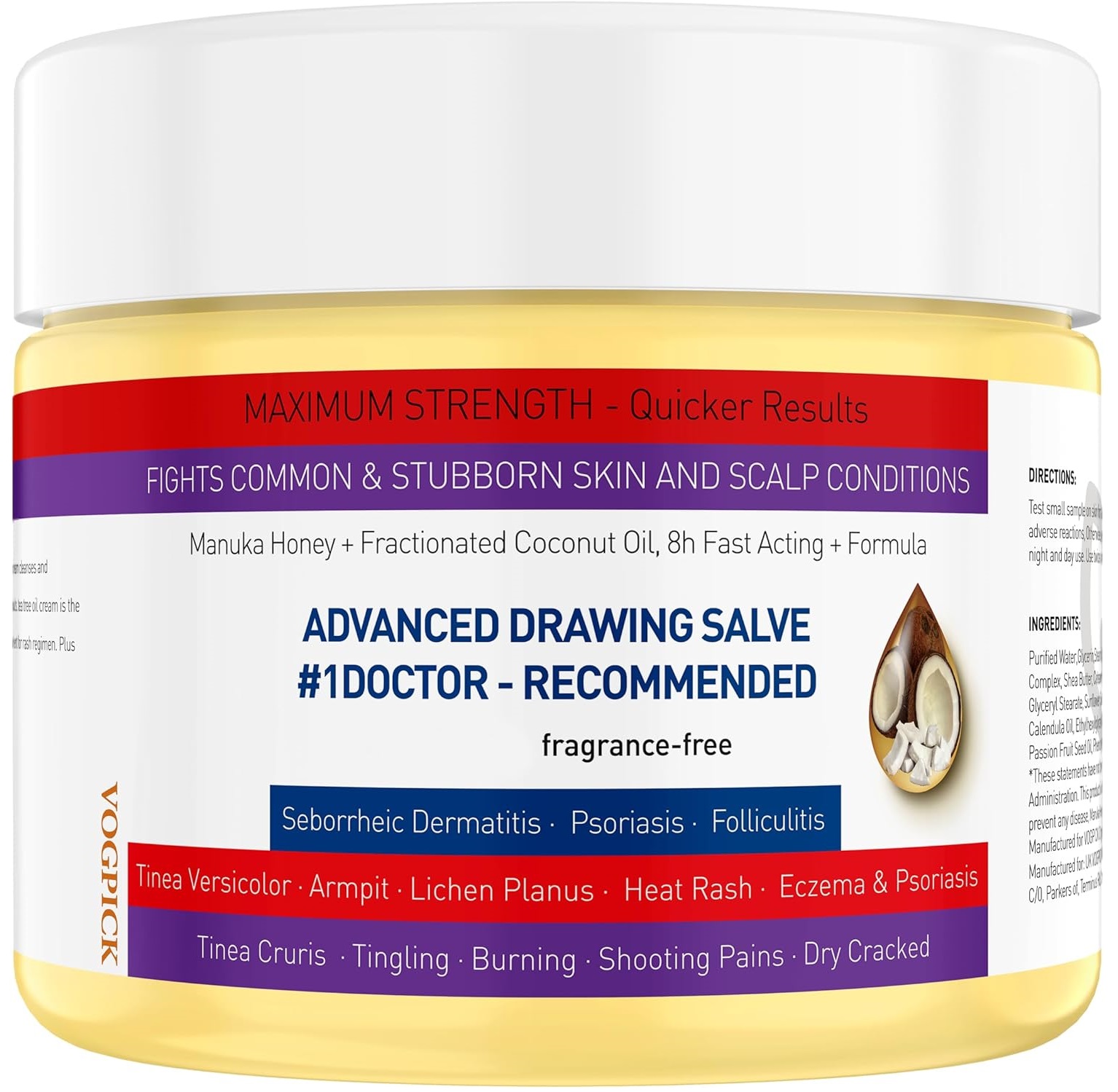 Best Treatments for Tinea Versicolor at Home in 2024