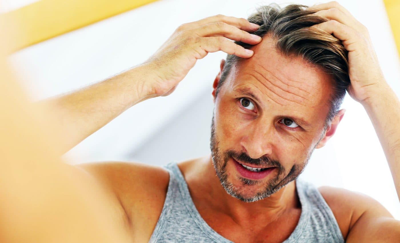 New and natural cure for male baldness is highly effective - Natural ...
