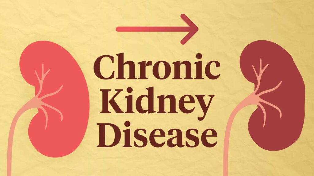 What Are the Primary Causes of Chronic Kidney Disease (CKD) in Adults ...